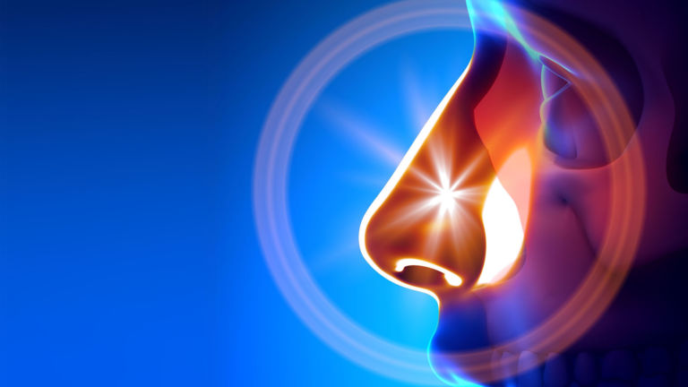 Allergic Conjunctivitis Associated With Sinus » Raffles Medical Group