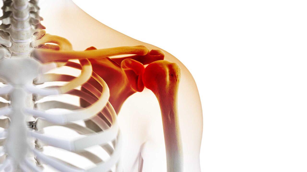 Frozen Shoulder » Raffles Orthopaedic Centre, Singapore