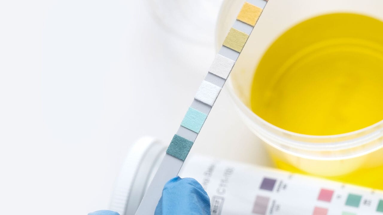 What Your Urine Says About Your Health » Raffles Medical Group